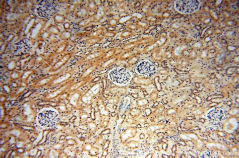 Erg Fusion Protein Ag9693 Proteintech