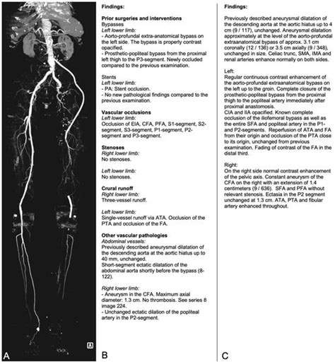 Impact Of Structured Reporting Of Lower Extremity Ct Angiography On Report Quality And Workflow
