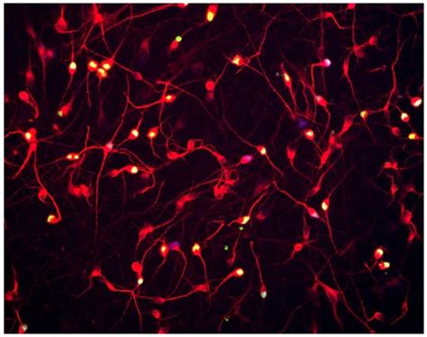 Cortical Glutamatergic Neurons Human Ipsc Derived Cells Gfp
