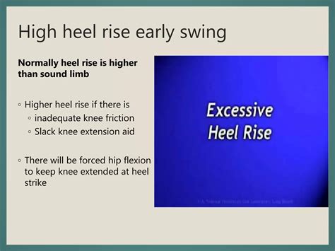 Prosthetic Gait Deviation Pptx