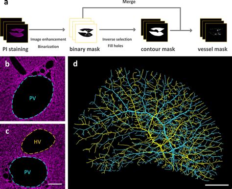 Reconstruction Of The Portal Vein And Hepatic Vein A The Reconstruction Download Scientific