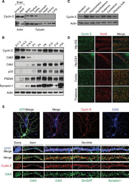 Cyclin E Expression In Postmitotic Neurons A Cyclin E Levels Were Download Scientific Diagram