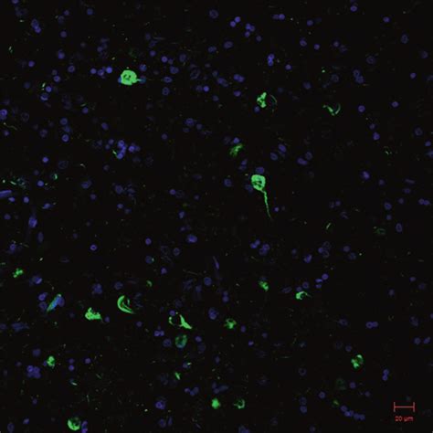 1 Hyperphosphorylated Tau Formed Tangles In The Ad Human Brain Human Download Scientific