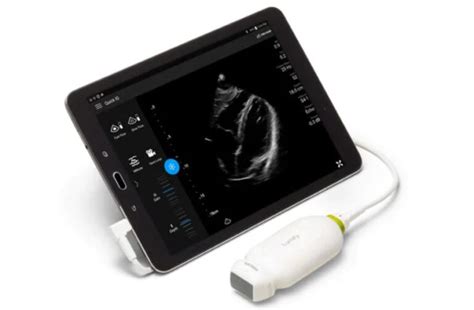 Philips Lumify The Ultrasound Source