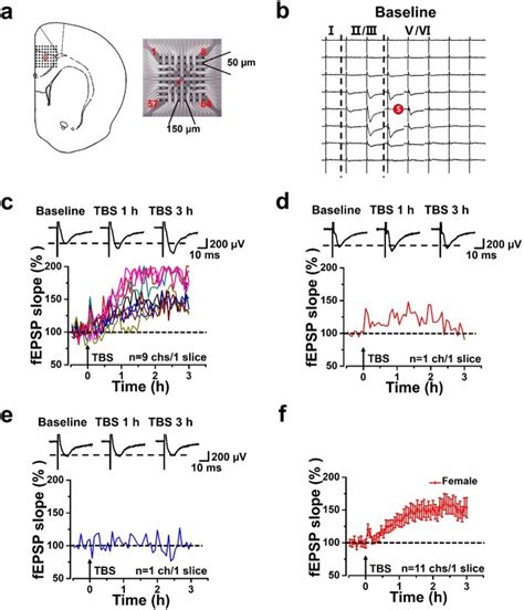 Sex Difference In Synaptic Plasticity In The Anterior Cingulate Cortex