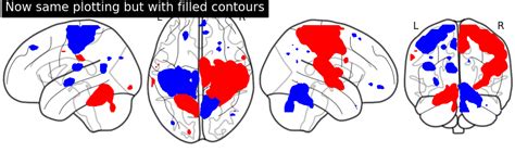 Glass Brain Plotting In Nilearn All Options Nilearn