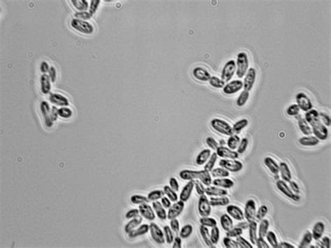 Candida Vini Viticulture And Enology