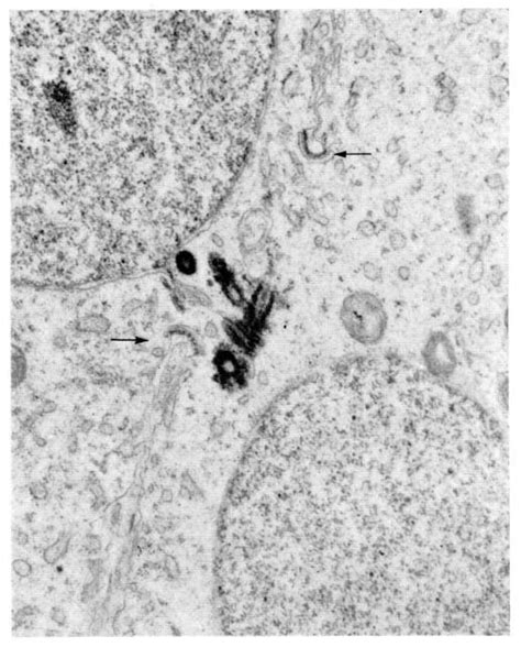 Two Hophop Spermatids Joined By A Normal Intercellular Bridge
