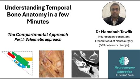 Understanding Temporal Bone Anatomy In A Few Minutes Part I Schematic