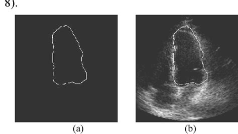 Figure 1 From Improved Segmentation Of Echocardiographic Images Using