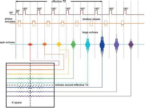 Mri Pulse Sequence Pptx