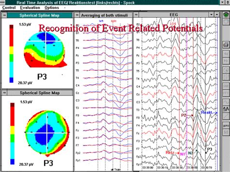 SoftComputing Real Time Signal Analysis Speech Recognition EEG ECG Signal And Image