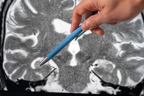 Memory Encoding In The Hippocampus Computational Models Illuminate Ca3