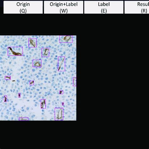 Mvd Being Calculated By The Automated Image Analyzer Using An Image ×
