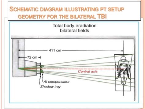 Total Body Irradiation Ppt For Radiologypptx