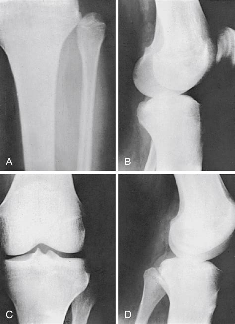 Acute Dislocations Clinical Tree Acute Dislocations Clinical Tree