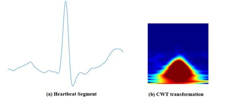 Continuous Wavelet Transformation A A Segment Of Ecg Signal B Cwt