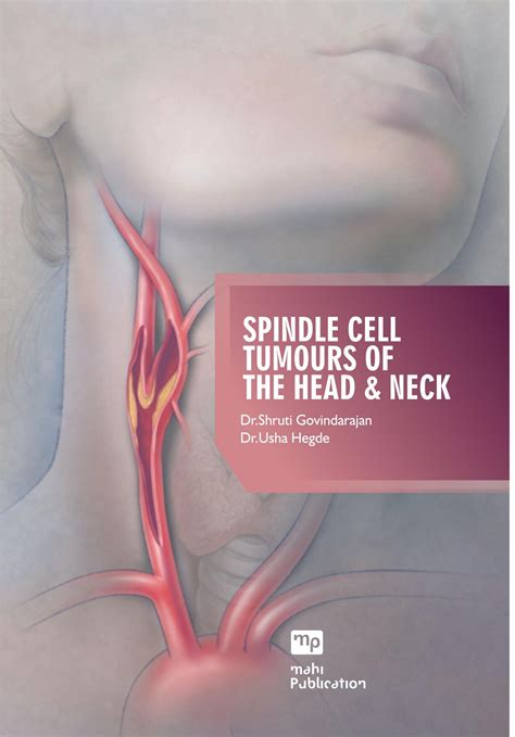 Spindle Cell Tumours Of The Head And Neck Dr Shruti Govindarajandr
