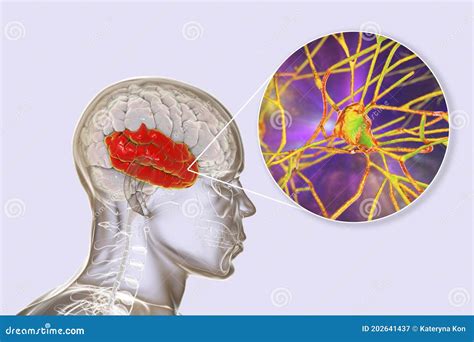 Human Brain With Highlighted Temporal Lobe And Close Up View Of Neurons Stock Illustration