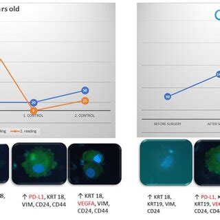 CTC Follow Up During One Year Period We Demonstrate Changes During The Download Scientific