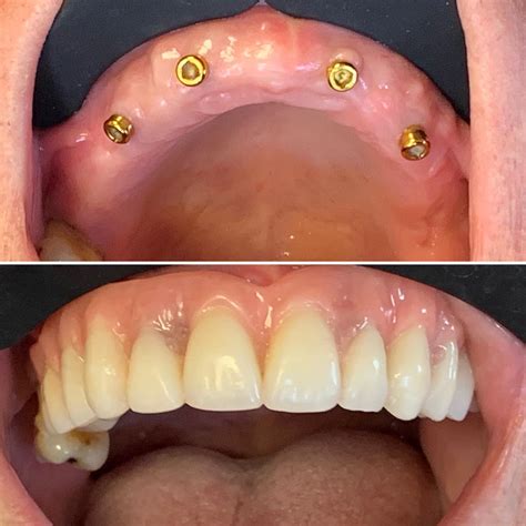 Dr Hardeep Bratch Added A New Photo — Dr Hardeep Bratch