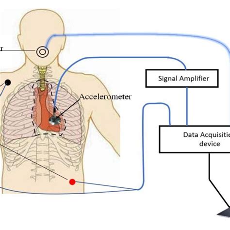 Segmentation Of The Scg Signal Using Ecg Beats Download Scientific