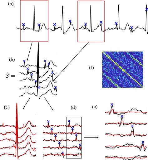 figure 1 from data driven optimal shrinkage of singular values under