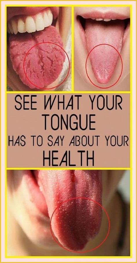 What Your Tongue Says About Your Health Artofit