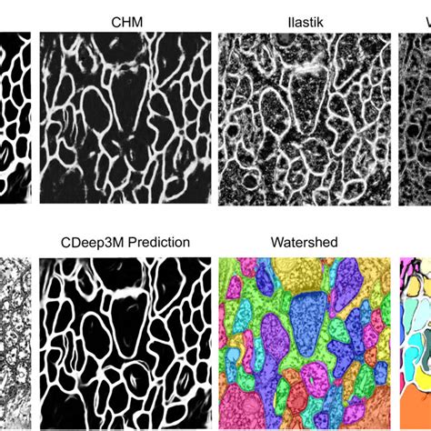 Comparison Of Membrane Segmentation On Sset Data Using Cdeep3m And