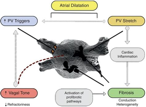 13 Atrial Flutter Fibrillation Thoracic Key