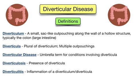 Diverticular Disease Diverticulitis Vs Diverticulosis 43 Off