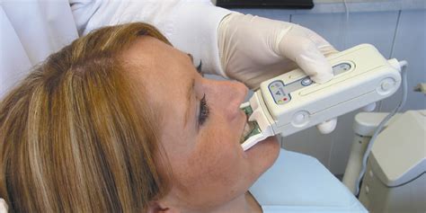 Expert Occlusion Analysis With T Scan