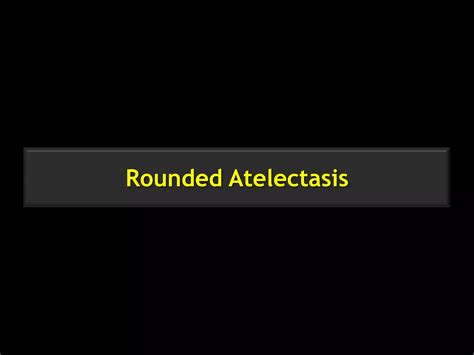 Types Of Atelectasis Occupational Lung Disease Comet Tail Sign Pptx