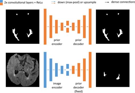 architecture for automated wmh segmentation the model first captures