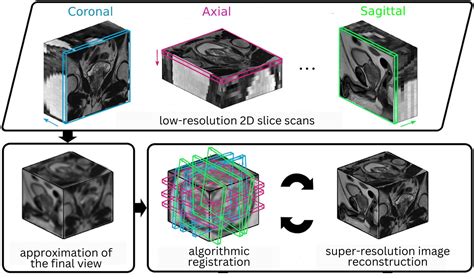 Image Generation Using Genai For Enhancing Visual Quality Of Radiology Scans