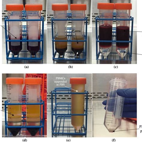 Isolation Of Peripheral Blood Mononuclear Cells Pbmcs By Density Download Scientific Diagram Isolation Of Peripheral Blood Mononuclear Cells Pbmcs By Density Download Scientific Diagram