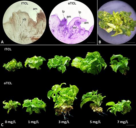 Shoot Regeneration From Ltcl And Otcl Explants In Medium Supplemented