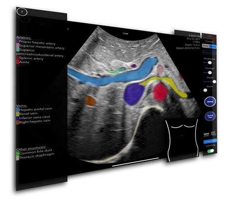 Welcome To Scanbooster The World S First Realistic Ultrasound