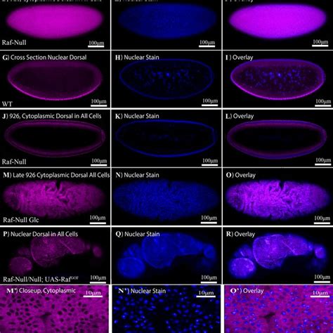 Dorsal And Erk Localization In Vitro A Nuclear Localization Of