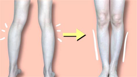 Eng휘어진 종아리 튀어나온 비골 👉🏻 11자로 만드는 방법 👈🏻백니 교정까지 꿀팁대방출 Youtube