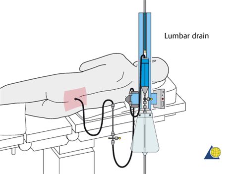 Lines Leads And Drains — In The Icu With Jessie Franco