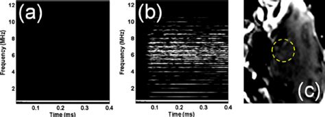 Color Online A The Spectrogram Without Microbubble Download Scientific Diagram