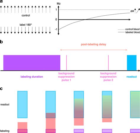 Timing Of The Pseudo Continuous Arterial Spin Labeling Sequence The Download Scientific