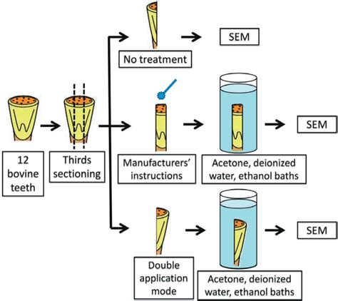 Flowchart Of The Etching Pattern Examined By Scanning Electron