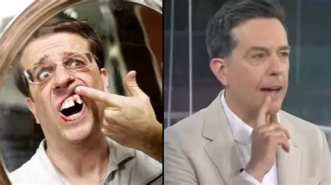 Ed Helms Removed His Actual Tooth For Role In The Hangover