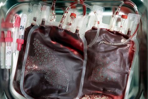 Why Hype For Autism Stem Cell Therapies Continues Despite Dead Ends