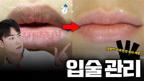 겨울에 입술 많이 건조하시죠 정답 알려드릴게요 그냥 따라 하세요 겨울철 입술 관리법 Youtube