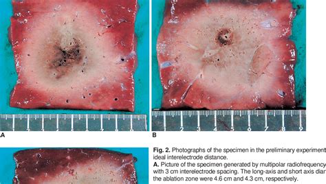 Figure 1 From Hepatic Radiofrequency Ablation Using Multiple Probes Ex Vivo And In Vivo