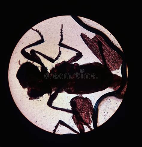 Tick Microscope Stock Image Image Of Tick Black Brown 15516169