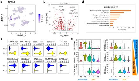 Subpopulations Of Cancer Distinct Fibroblasts A Umap Plot Showing Download Scientific